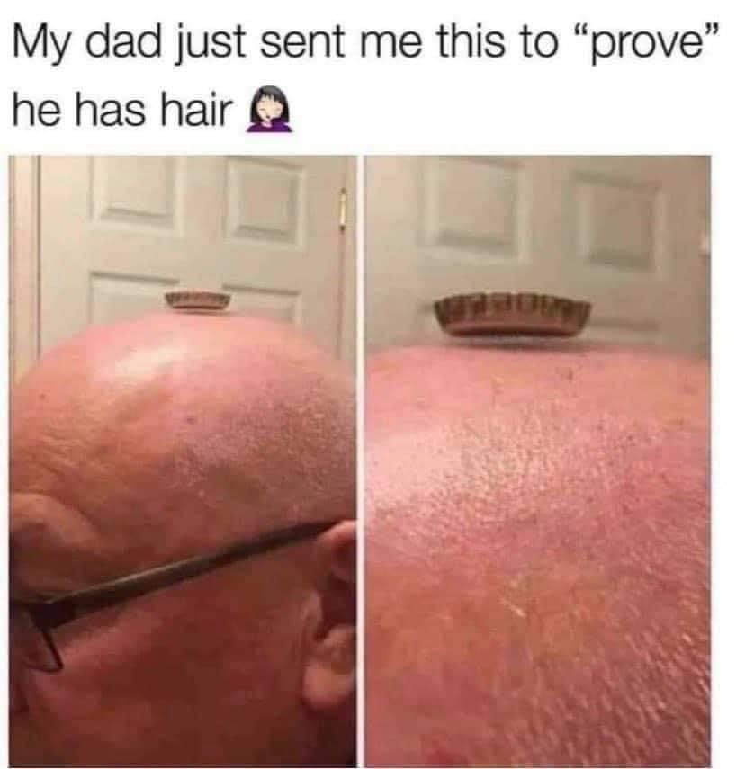 My Dad Just Sent Me This To Prove He Has Hair Pictures, Photos, and ...