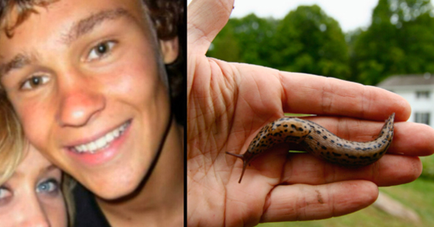 Teen Eats Slug As Prank - Days Later, He Learned This Grave Mistake ...
