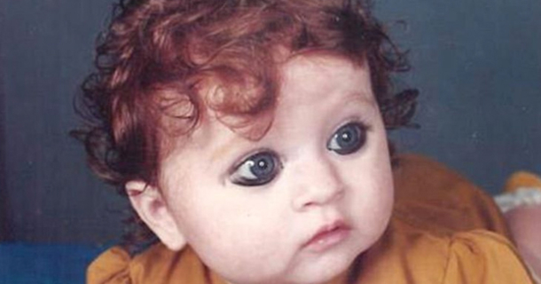 The Entire Delivery Room Gasped In Shock When They Saw This Baby’s Face