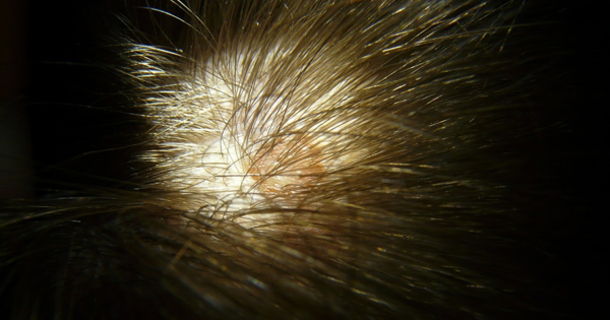 Try This Super Recipe For Hair Growth, It Will Leave You Speechless!