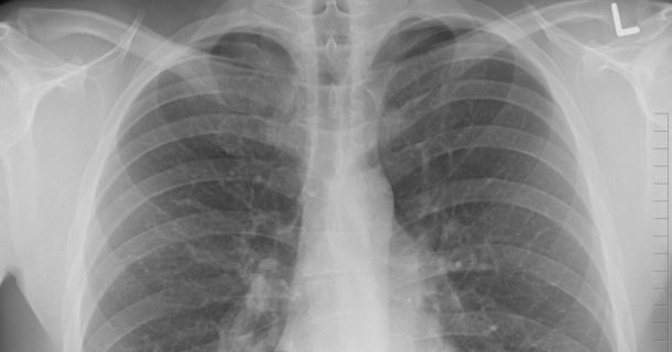 Rub these 2 points on your chest, and watch what happens to your body