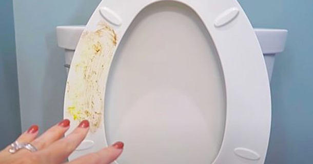 How To Get Rid Of Yellow Stains From The Toilet Seat And Lid