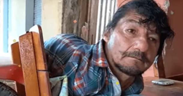 Father Without Limbs Raises Two Daughters Solo After Their Mother Abandons Them As Infants