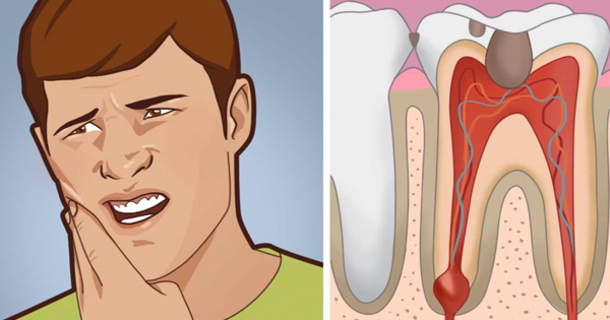 8 Natural Remedies To Soothe A Toothache