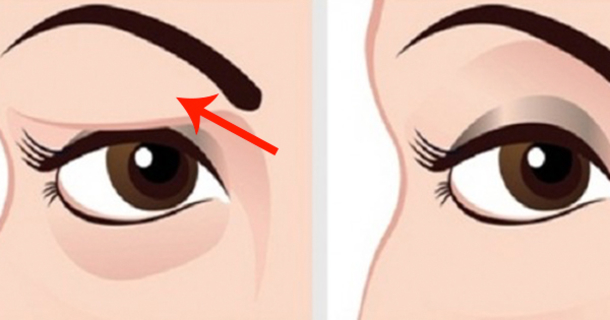 The Best & Natural Way To Sagging Eyelids, This Remedy Creates Instant ...