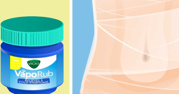 Use Plastic Wrap And Vicks VapoRub To Tighten Your Tummy, Here's How