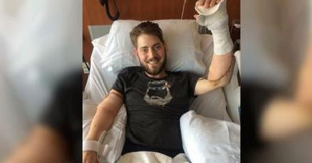 Marine Loses All 4 Limbs, Gets Double Arm Transplant So He Can Hold His ...