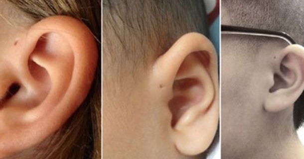 Here’s Why Some People Have an Extra Hole in Their Ears!