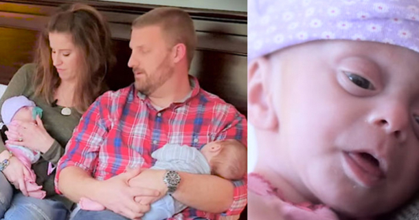 When No One Else Would, Couple Adopts Baby Without A Brain. But The ...