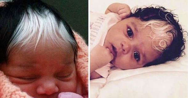 The girl born with white hair forelock is a real star on the internet ...