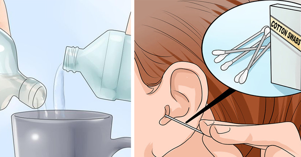 This 2-Ingredient Mixture Will EFFECTIVELY Eliminate Earwax And Ear ...