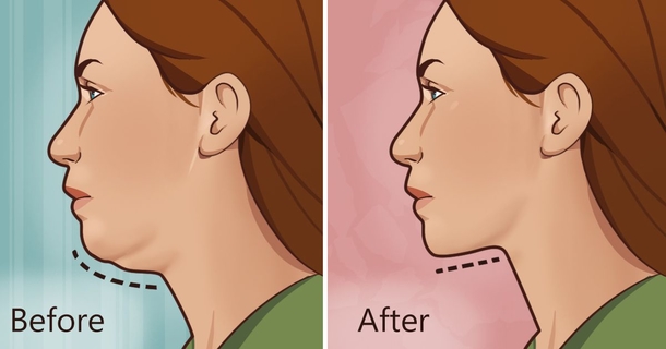 Want To Get Rid Of Stubborn Double Chin And Neck Fat? These 10 Easy ...
